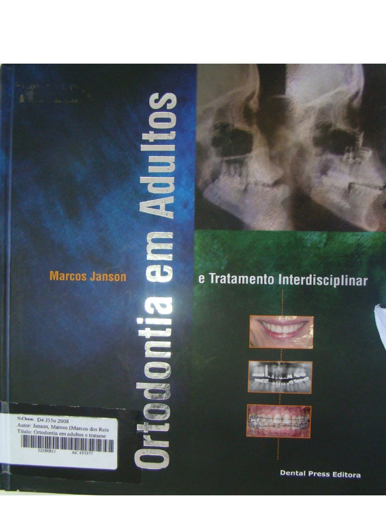 Ortodontia em Adultos - Marcos Janson - 2008 - Cópia | PDF