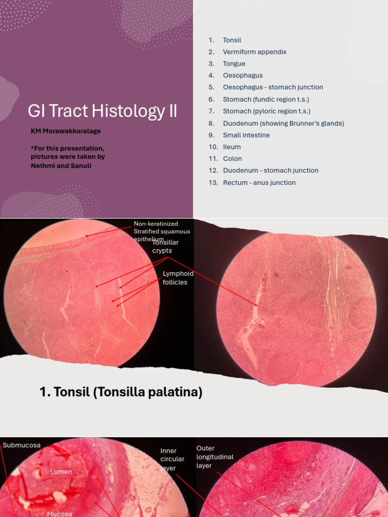 GI Tract Histology II | PDF | Stomach | Gastrointestinal Tract