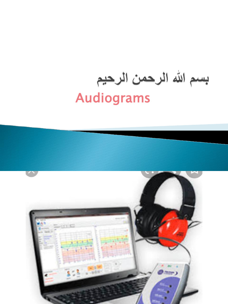 Audiogram notes | PDF