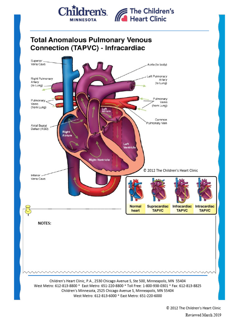 Total Anomalous Pulmonary Venous Connection Tapvc Infracardiac | PDF ...