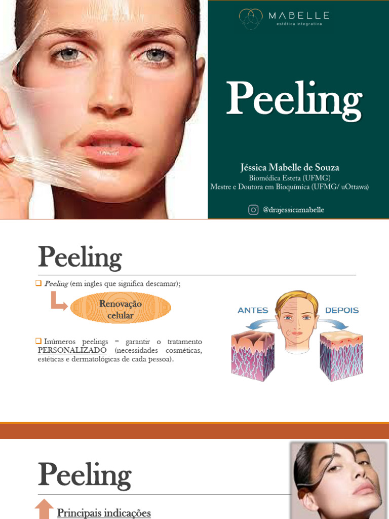 Aula 5 - Peeling | PDF | Dermatologia | Especialidades médicas