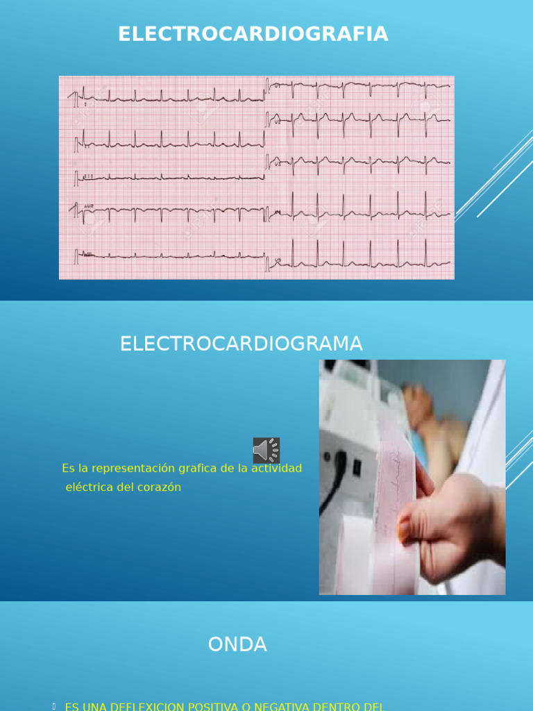 Electrocardiografia | PDF | Fisiología | Electrocardiografia