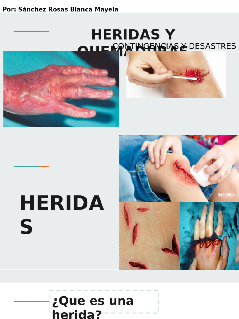 Heridas y Quemaduras | PDF | Herida | Quemar