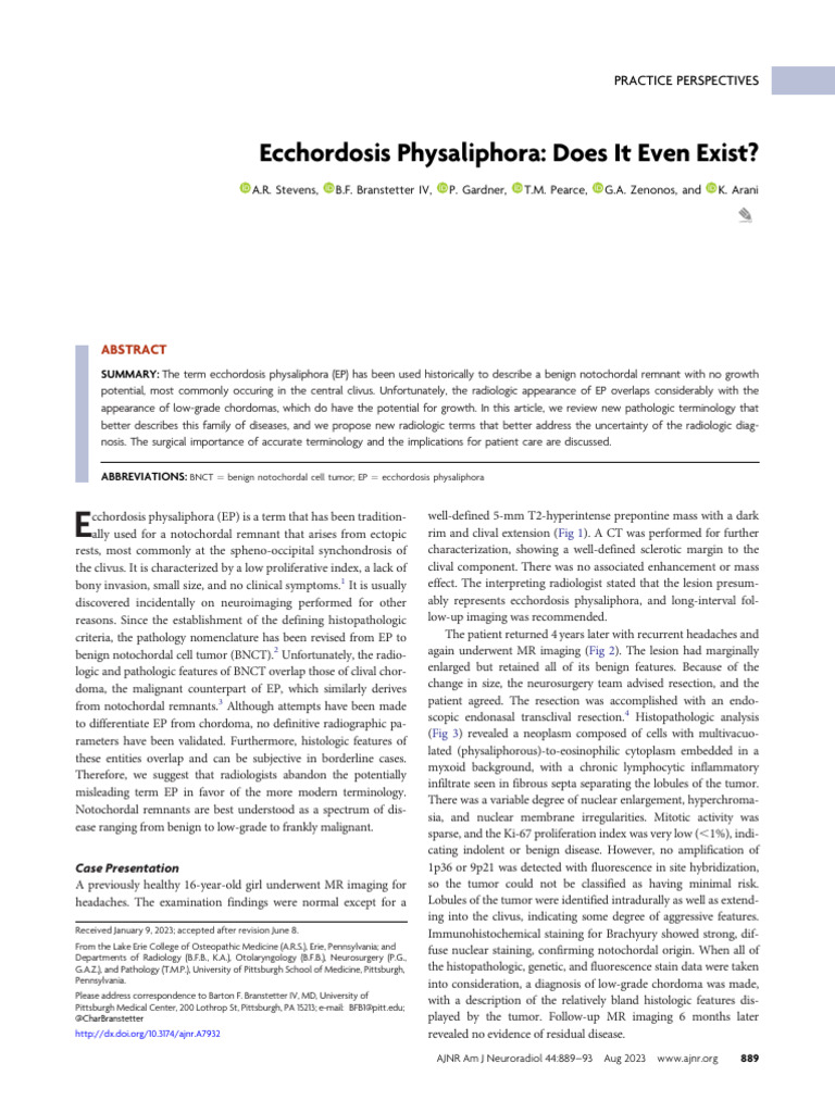 2023 Ecchordosis Physaliphora Does It Even Exist | PDF | Neoplasms ...