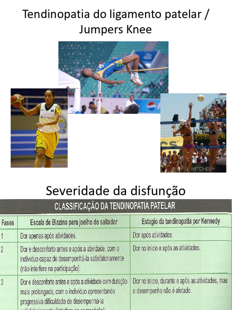 Tendinopatia do ligamento patelar | PDF | Causas de morte | Medicina Clínica