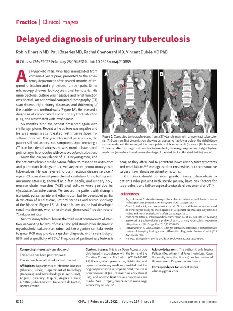 E310.full | PDF | Urinary Tract Infection | Tuberculosis