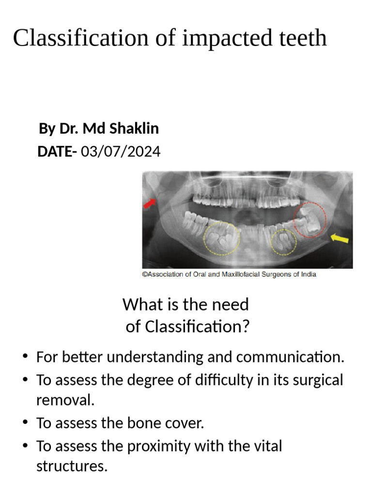 Classification of Impacted Third Molars | PDF | Dentistry | Tooth