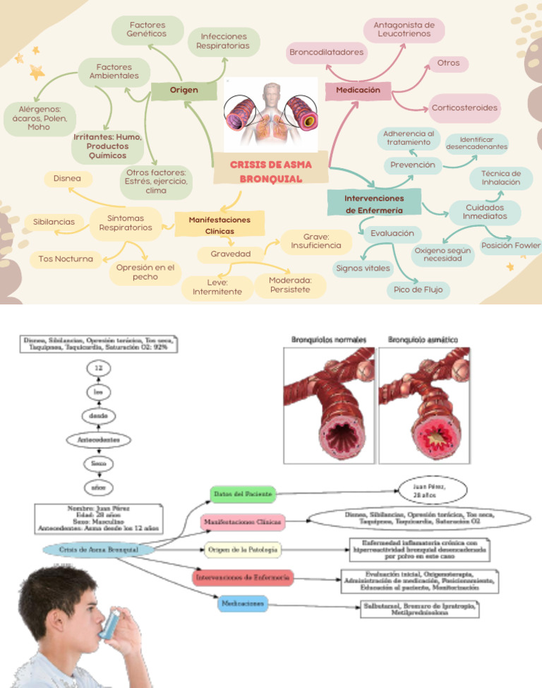Mapa Mental - Grupo 1 - Crisis de Asma Bronquial | PDF | Asma | Medicina