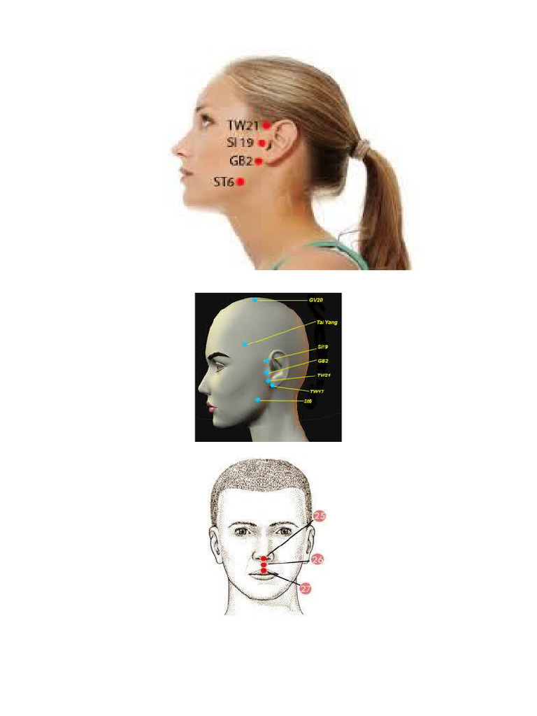 Acu Points | PDF | Sleep | Clinical Medicine