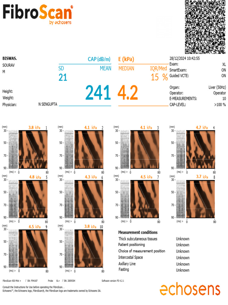 Fibroscan Sourav Biswas Jan 2025 | PDF | Anthropometry | Medical Imaging