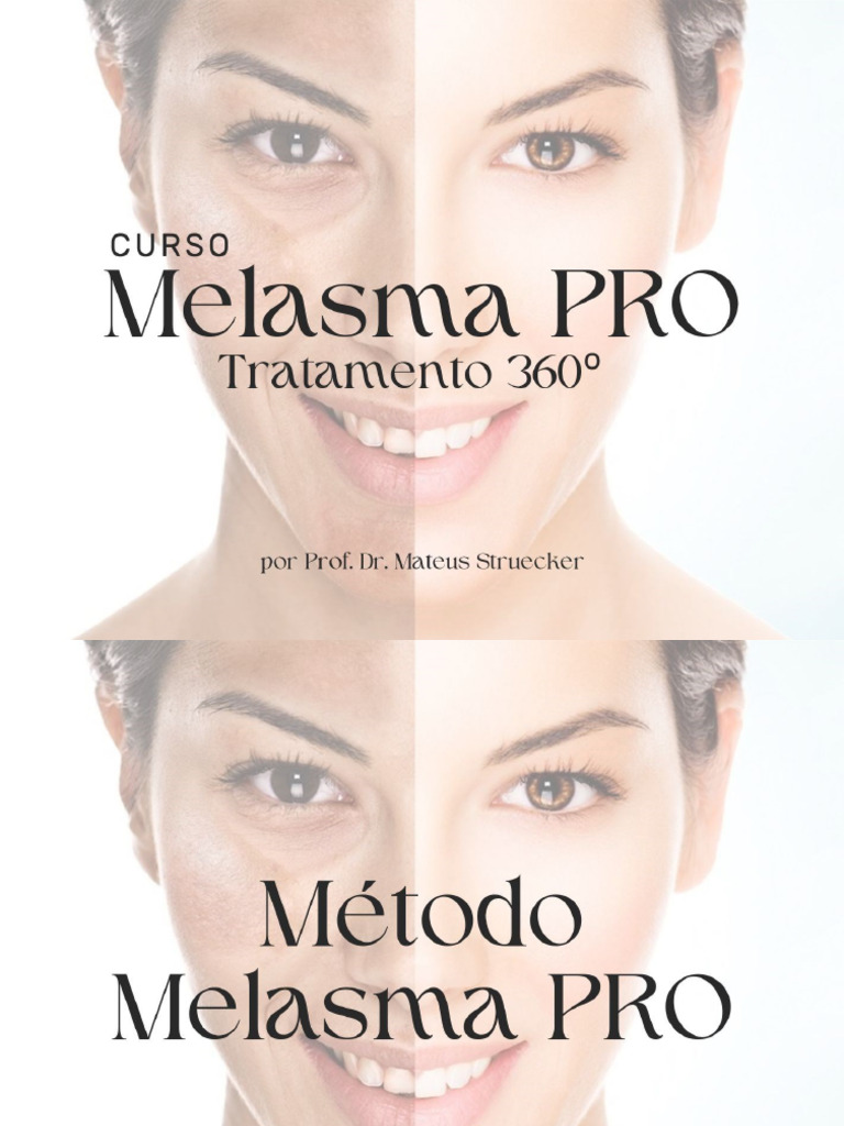 Guias Parte II- Método Melasma PRO - Curso Melasma PRO | PDF | Química