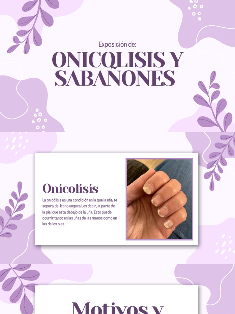 Enfermedades Onicolisis y Sabañones .pdf | PDF