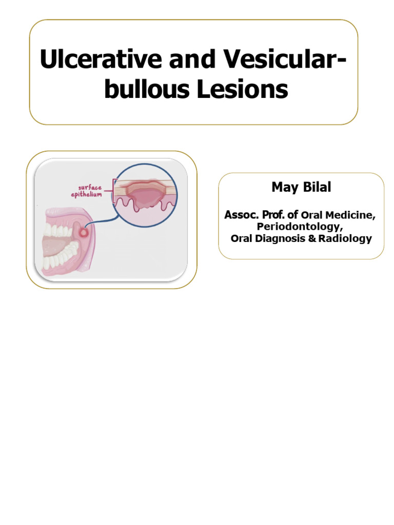 Oral Ulcers-1 WHITE | PDF | Clinical Medicine | Causes Of Death