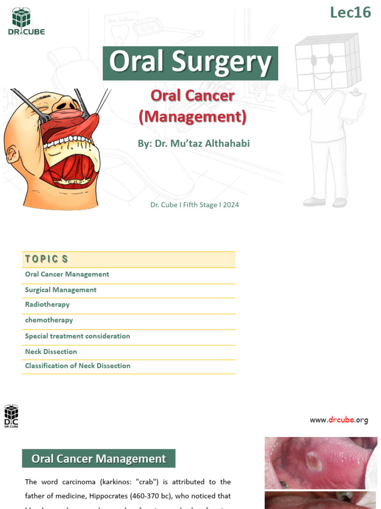 Oral Surgery5 Lec.9 P.2 Oral Cancer | PDF | Radiation Therapy | Neck