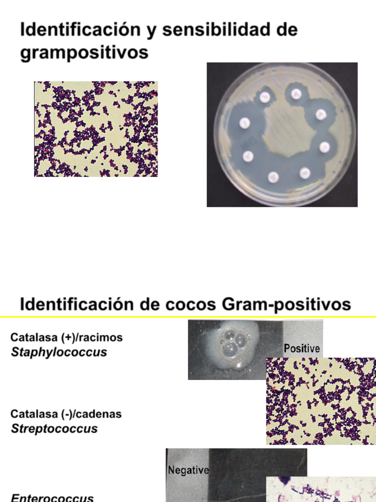 2023 ID y AST Gram+ y Antibióticos 3º Facultad | PDF | Staphylococcus ...