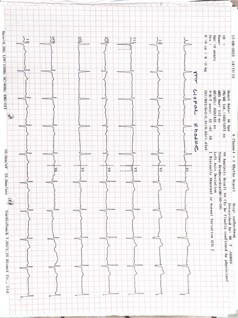 ECG Daily | PDF