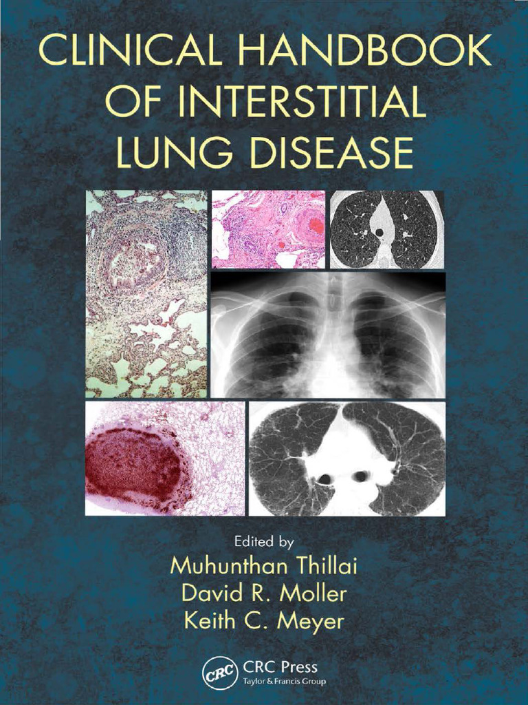 ILD book | PDF | Diseases And Disorders | Medical Specialties