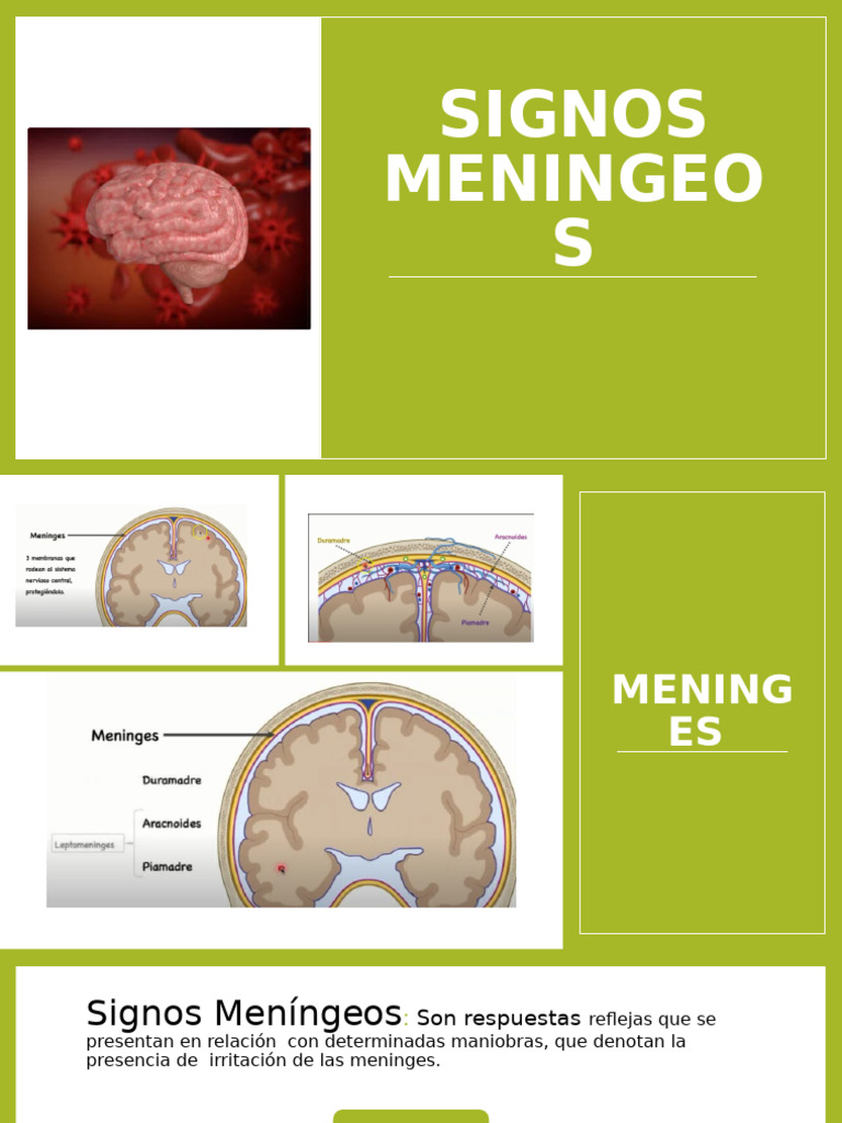 Signos Meningeos | PDF | Meningitis | Medicina CLINICA