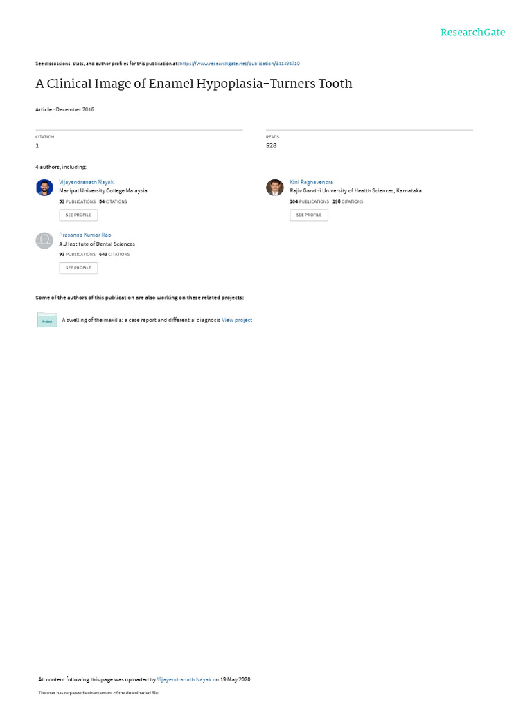 A Clinical Image of Enamel Hypoplasia-Turners Tooth | PDF | Human Tooth ...