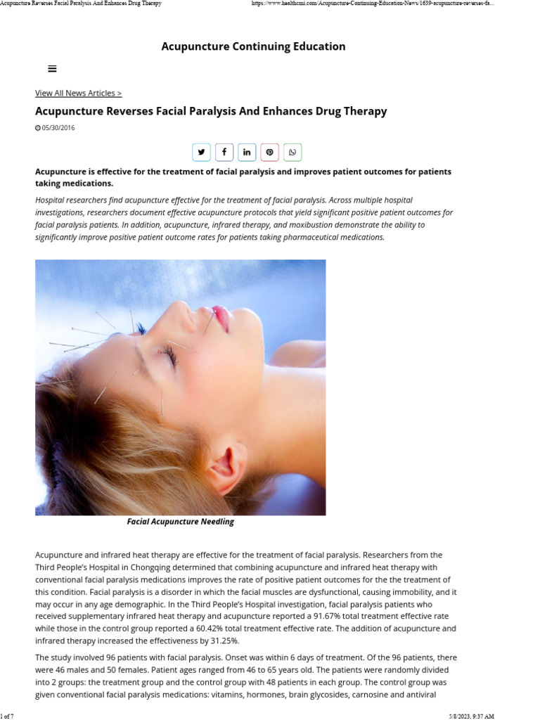 Acupuncture Reverses Facial Paralysis And Enhances Drug Therapy | PDF | Acupuncture ...
