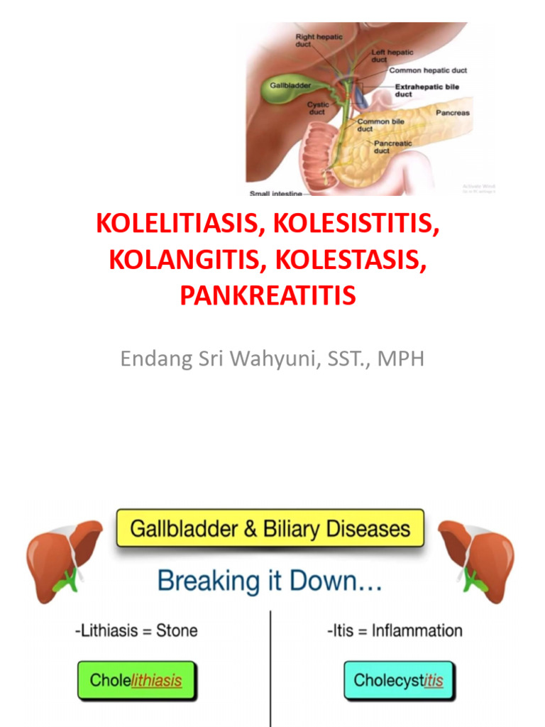 Kolelitiasis, Kolesistitis, dan Kolangitis | PDF