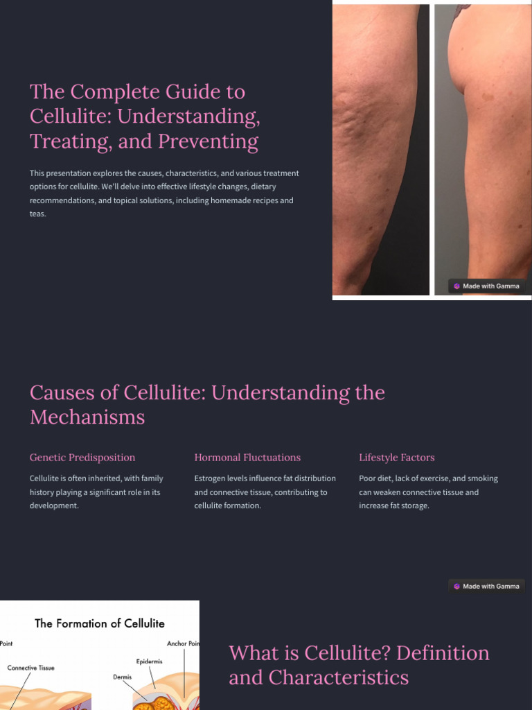 The-Complete-Guide-to-Cellulite-Understanding-Treating-and-Preventing | PDF | Fat | Adipose Tissue