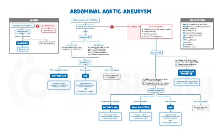 Abdominal Aortic Aneurysm | PDF