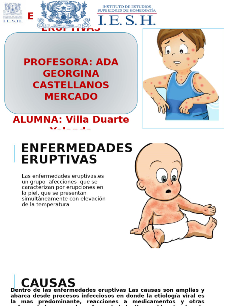 Enfermedades Eruptivas: Causas y Tratamientos | PDF | Medicina CLINICA ...