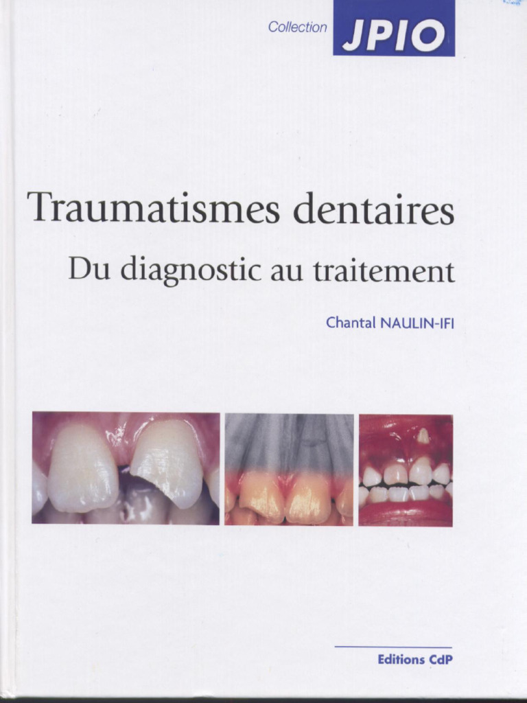 Traumatisme Dentaire JPIO | PDF