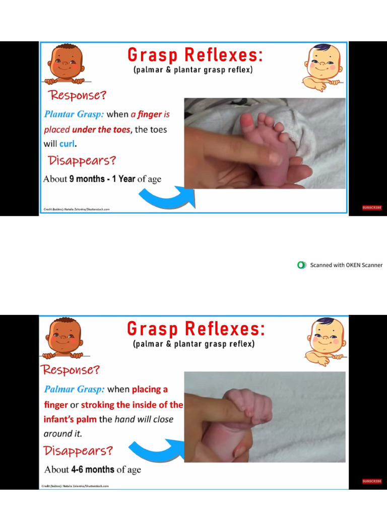Neonatal Reflexes | PDF
