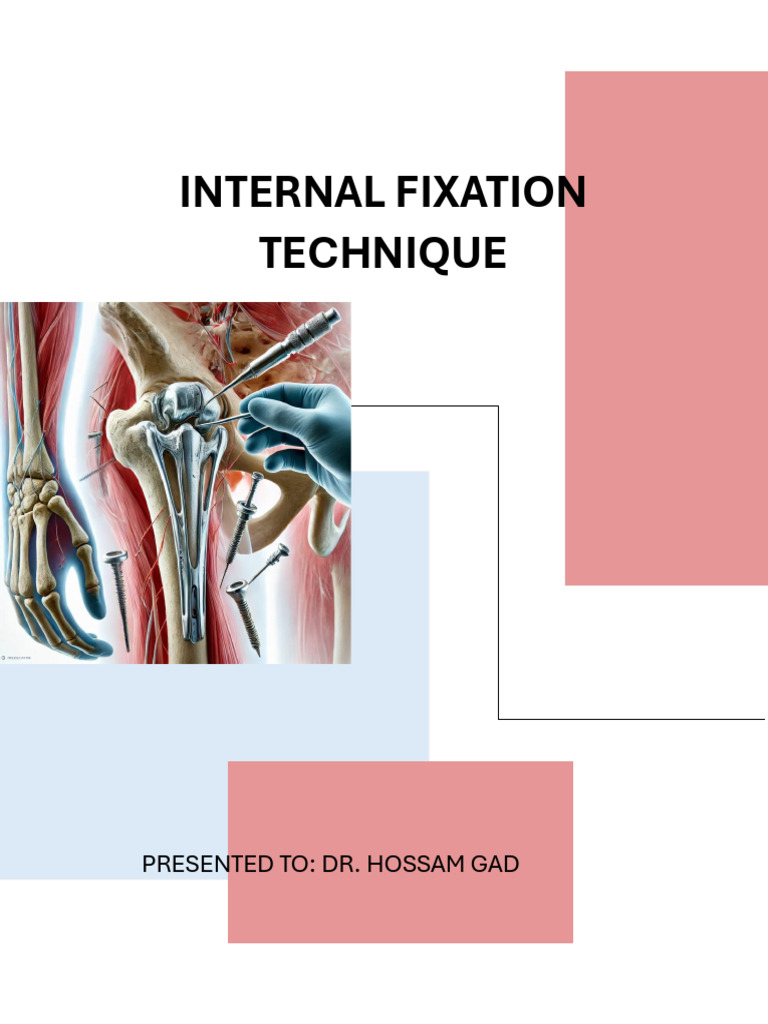 Internal Fixation Techniques Overview | PDF | Surgery | Vertebral Column