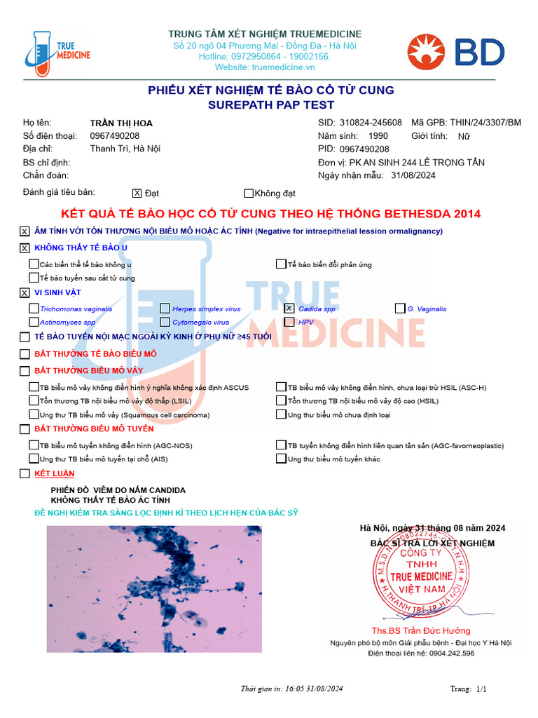 Tran Thi Hoa 310824-245608 | PDF