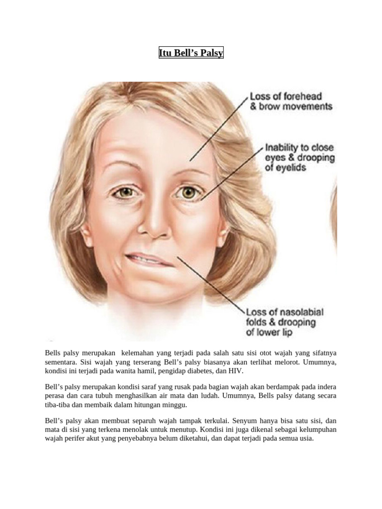 BELL PALSY | PDF