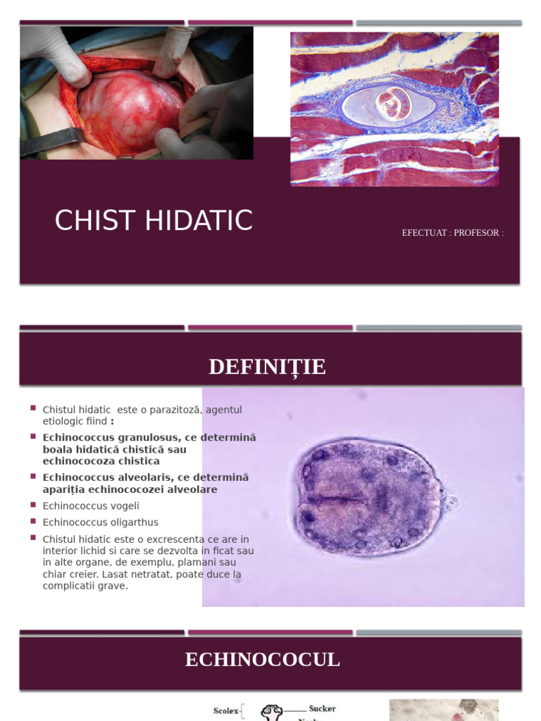 Chist Hidatic | PDF