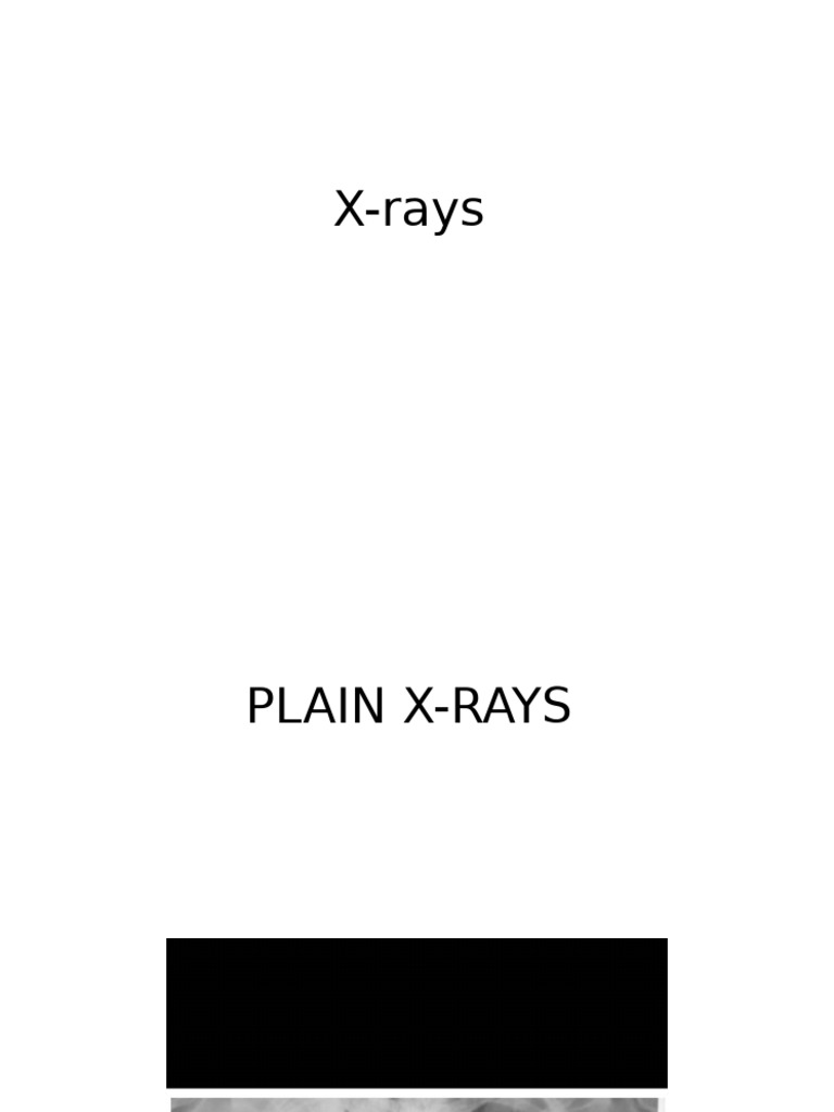 X-Rays Exam 1 | PDF
