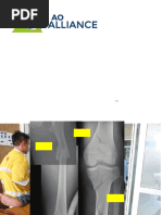 AO/OTA Fracture Classification Guide | PDF | Injury | Skeletal System