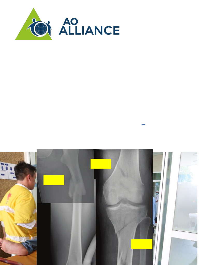 1.2 AO Classification | PDF | Musculoskeletal System | Skeletal System