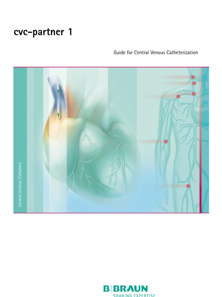 CVC Partner 1 | PDF | Intravenous Therapy | Vein