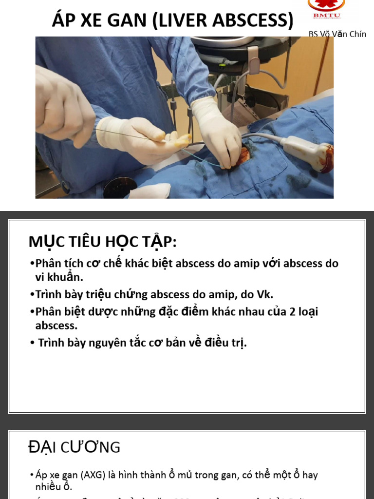 Áp xe gan | PDF