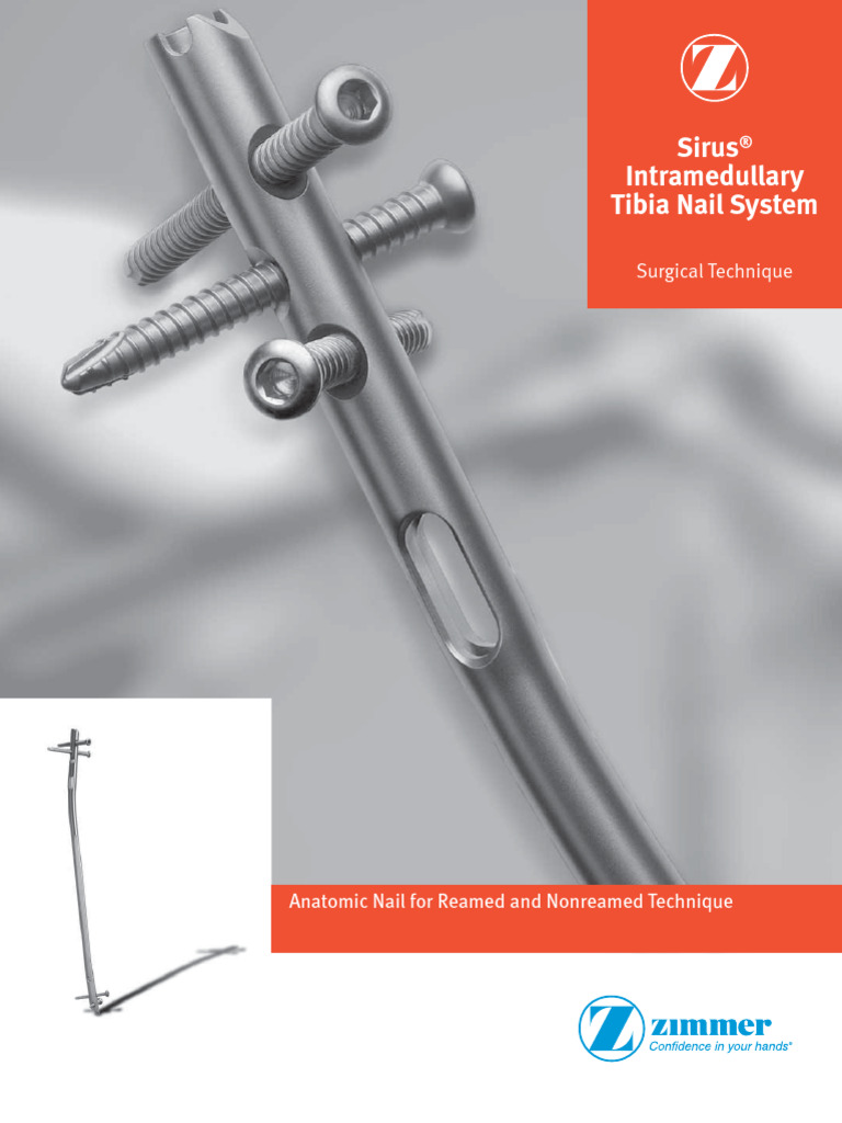 Sirus Intramedullary Tibia Nail System: Surgical Technique | PDF | Knee ...