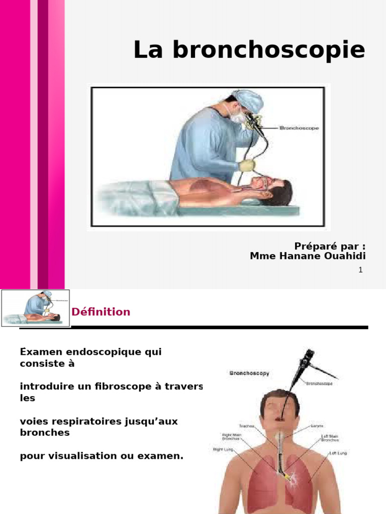 Guide complet sur la bronchoscopie | PDF | Biopsie | Maladies et troubles