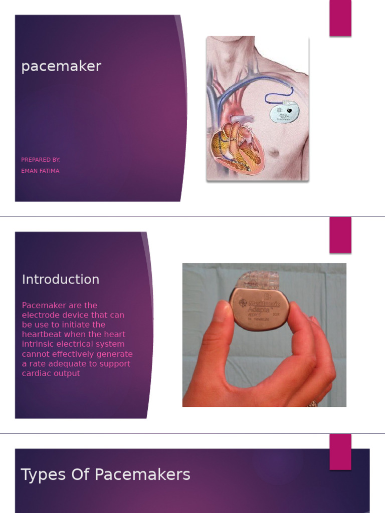Pacemaker Presentation | PDF