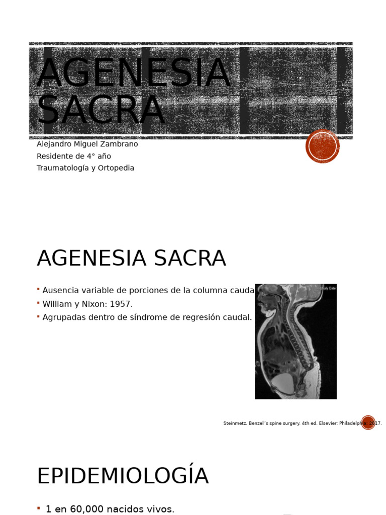 Agenesia Sacra | PDF