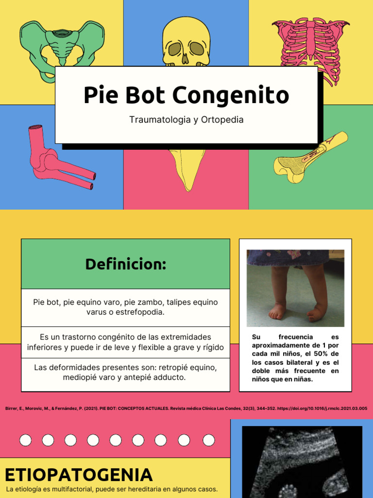 Pie Bot Congenito. | PDF | Pie | Enfermedades y trastornos