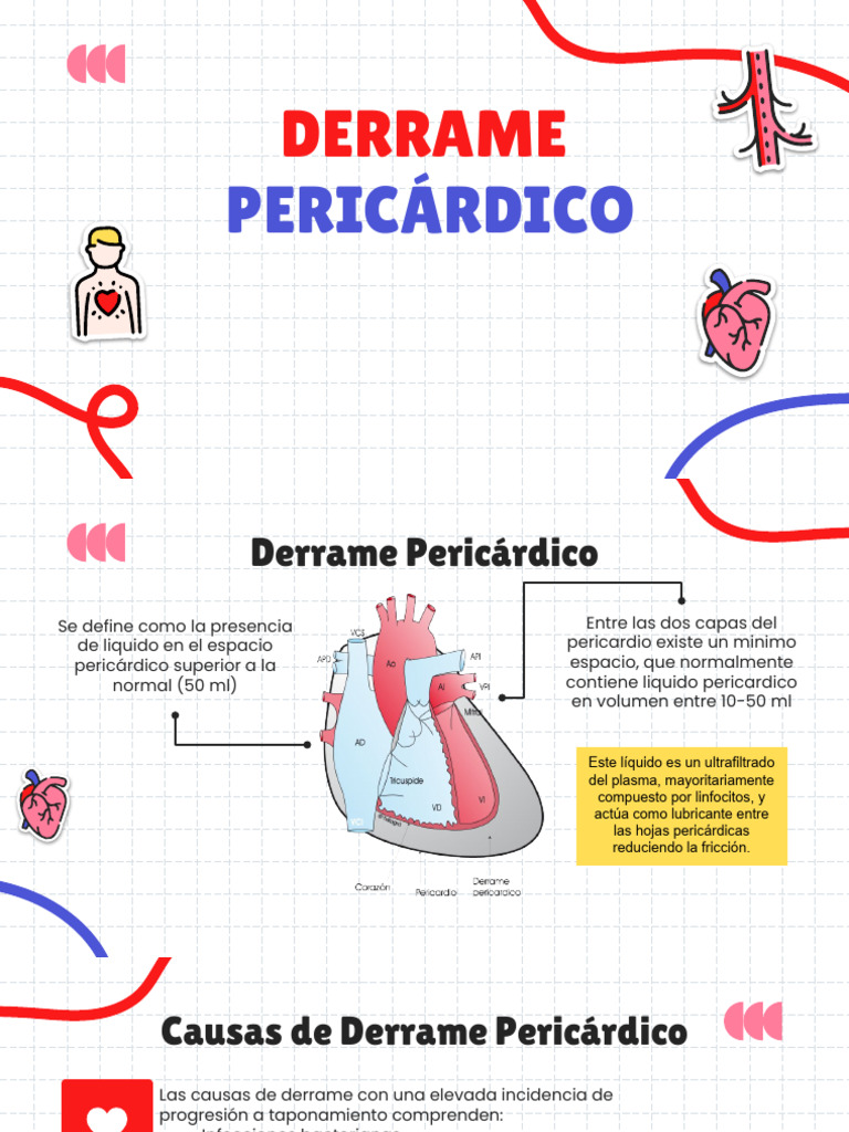 Derrame Pericárdico: Causas y Tratamiento | PDF | Medicina CLINICA | Enfermedades y trastornos