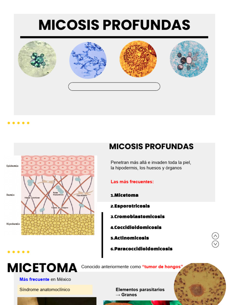 Micosis Profundas: Tipos y Tratamientos | PDF | Tuberculosis | Medicina ...