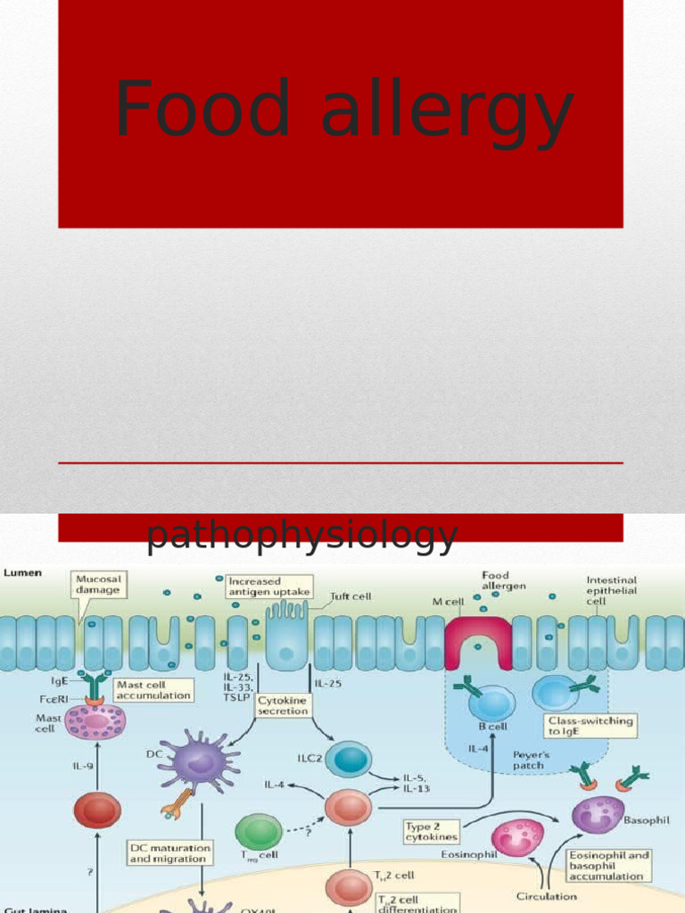 Food Allergy | PDF | Allergy | Food Allergy
