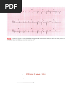 ECG Quiz: Key Questions & Answers | PDF | Electrocardiography ...