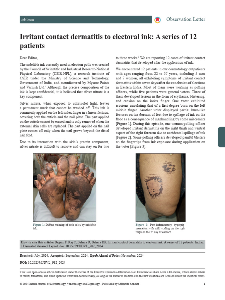 RKD WV0 X 6 Enl ZZGFP K0 H UK1 Da Ykx JQT09 | PDF | Ink | Dermatitis