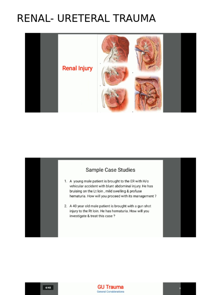 Renal-Ureteral Trauma Overview | PDF